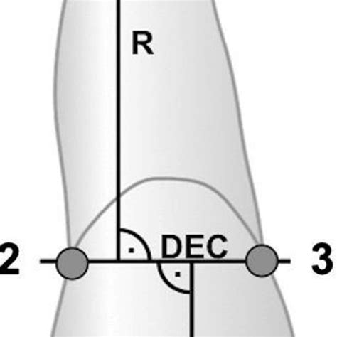 X Ray Measurement Of Root Resorption Reference Points 1 Root Apex 2 Download Scientific