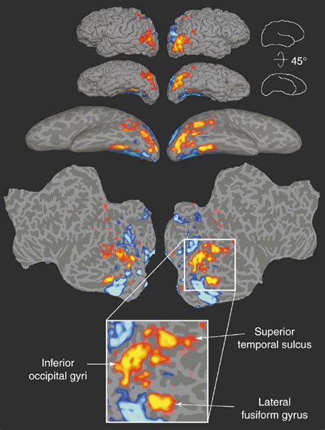Cortical Activation During Fmri Measurement Associated With The Download Scientific Diagram