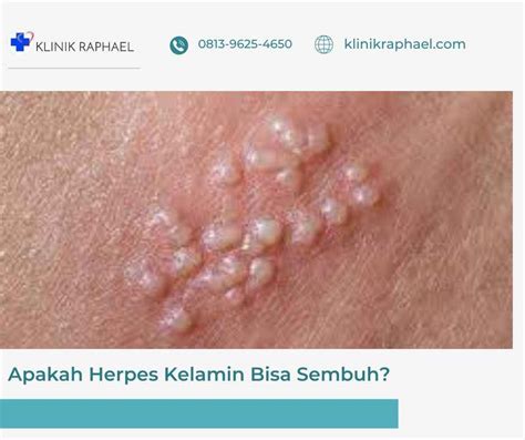 Ciri Urine Normal Berdasarkan Warna Dan Baunya