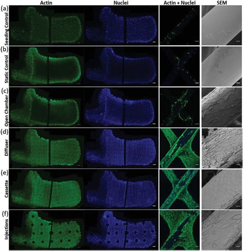 Personalized Volumetric Tissue Generation By Enhancing Multiscale Mass
