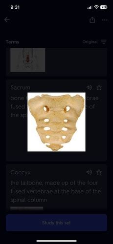 Bone Lab Exam Last Flashcards Quizlet