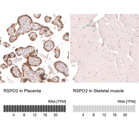 Mouse Monoclonal Anti Rspo2 Antibody Buy For Research Highly Specific Rigorously Validated