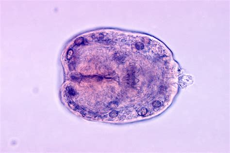 Echinococcus Granulosus Cabi Compendium