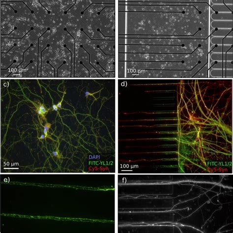 Optical And Fluorescent Micrographs Of Random And Microfluidic Networks