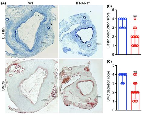Type 1 Ifn Receptor Subunit 1 Deficiency Reduces Medial Elastin