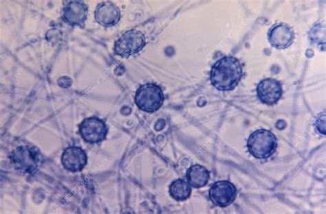 Histoplasma Capsulatum Dimorphic Fungal Pathogens Mycology