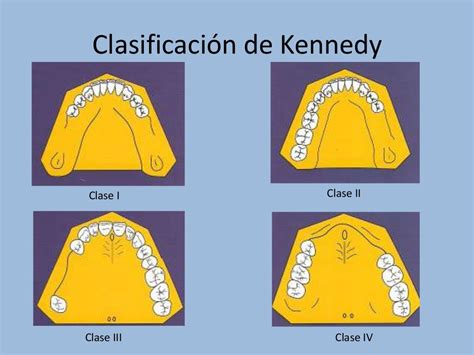 Seminario N°12 Kennedy