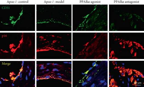 Pparα Inhibits Aging Of Endothelial Cells In The Apoe Mouse Model Download Scientific