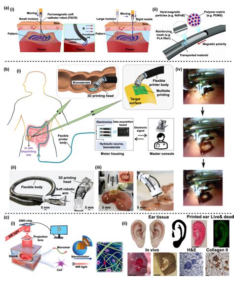 Minimally Invasive And Non Invasive In Situ Bioprinting A I Download Scientific Diagram