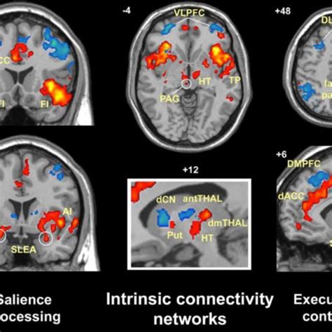 1 The Salience Network Red And Executive Control Network Blue