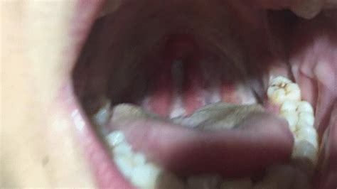 Uvula Sore Throat And Gag Reflex K Grace Clips4sale