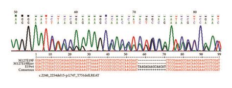 Examples Of Observed Mutations A Exon 19 Deletion B Missense Download Scientific Diagram