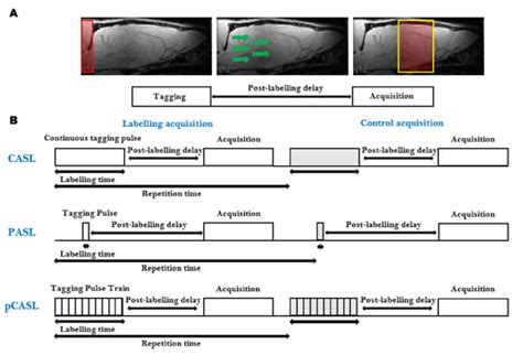 Arterial Spin Labeling Asl A The General Asl Scheme Consists Of Download Scientific