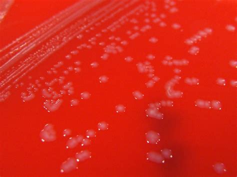 Pasteurella Multocida