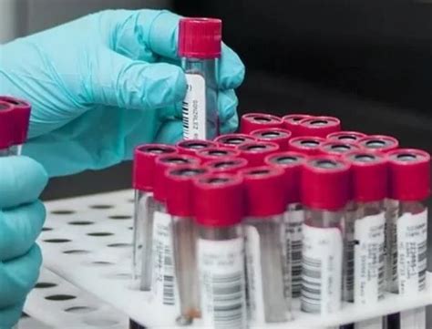 9 те кръвни показатели важни за ЗДРАВЕТО ни