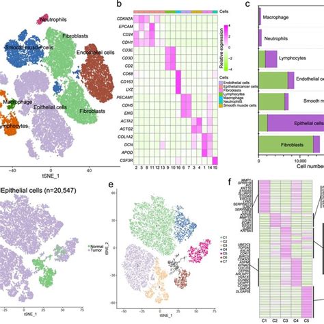Tumor Heterogeneity Of Cc At Single Cell Resolution A Umap Download Scientific Diagram