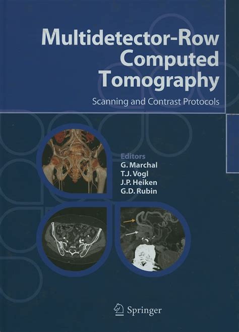 Multidetector Row Computed Tomography Scanning And Contrast Protocols 9788847003057 Medicine