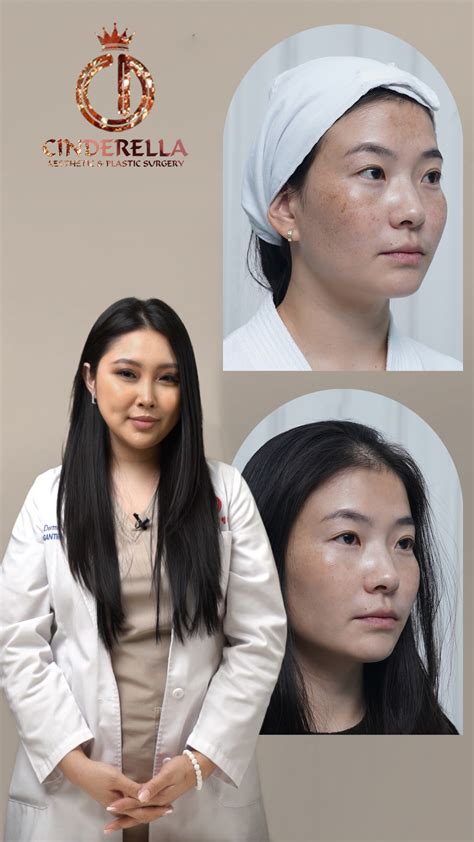 Хүн бүрийн арьсны онцлог сэвхний төрлүүд өөр тул гарах эмчилгээний үр дүн мөн адил харилцан