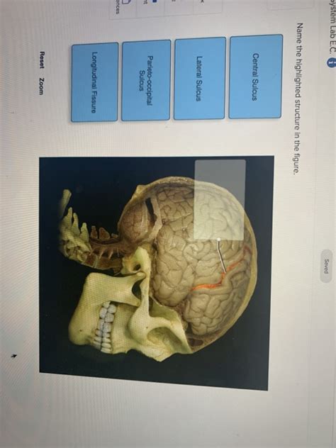 Solved System Lab E C G Saved Name The Highlighted