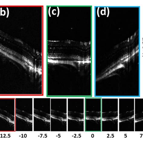 A Schematic Of The Ssoct System Used For Directional Oct Imaging Dc Download Scientific