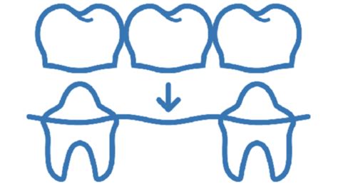 1 Intro To Rpds And Kennedy Classification Flashcards Quizlet
