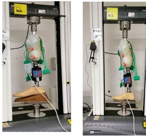 Table 1 From Pressure Distribution Management System In 3d Printed Transtibial Prosthetic Socket