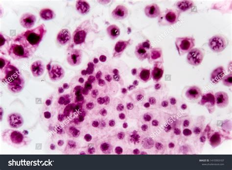 Meiosis Stages Under Microscope