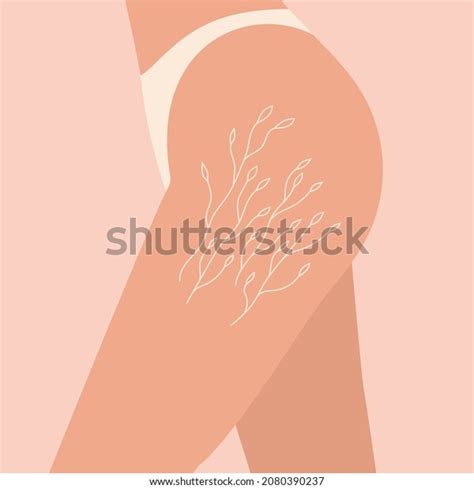 Stretch Marks Concept Over 312 Royalty Free Licensable Stock Vectors And Vector Art Shutterstock