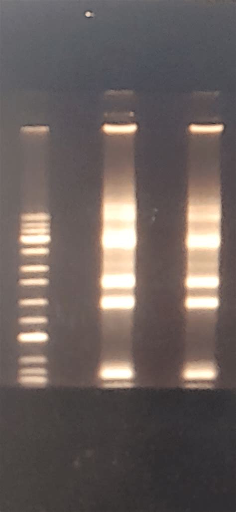 Does The Total Rna Contaminated By Dna Researchgate