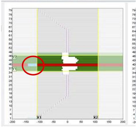 A Snapshot Of An Imrt Step‐and‐shoot Delivery That Captures Number 40