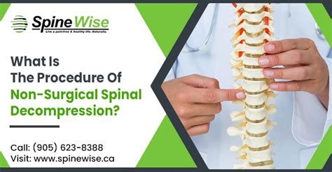What Is The Procedure Of Non Surgical Spinal Decompression Spinewise