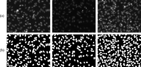 Figure 1 From Nuclei Segmentation Using Cascaded Bilateral Attention U Net Semantic Scholar