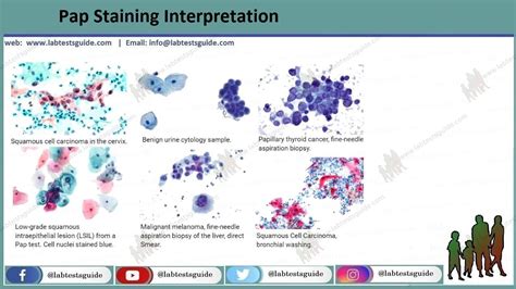 Simple Staining Principle Procedure And Result Interpretation Bixgy