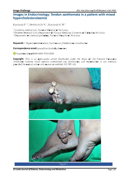 Pdf Images In Endocrinology Tendon Xanthomata In A Patient With