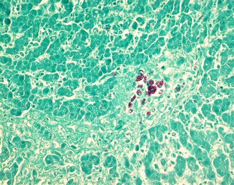 Afb Staining Kit For Histology 132450