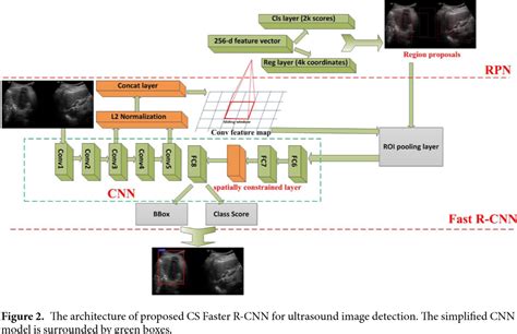 Thyroid Nodule Diagnosis Xiaoqian Zhang A Blog Where I Write Down