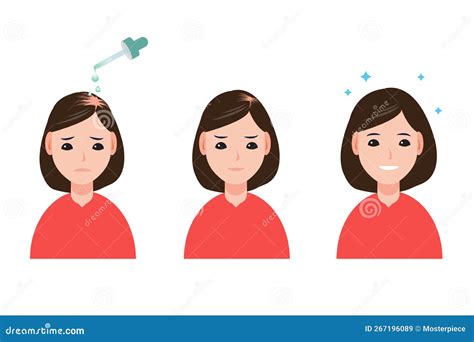 Hair Density Types Chart Of Low Medium High Strand Volume Royalty