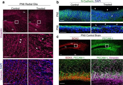 Radial Glial Progenitors And The Ventricular Neuroepithelium Are Download Scientific Diagram