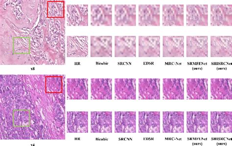 shisrcnet super resolution and classification network for low
