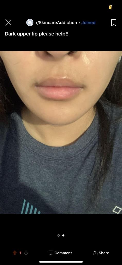 Product Request Dark Upper Lip Skin Rskincareaddiction