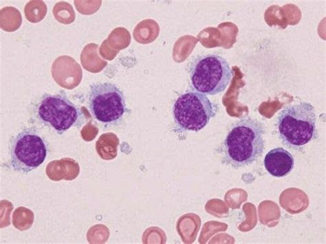 Gp Ai Project Cell Detection Object Detection Dataset And Pre Trained Model By Gp Repository