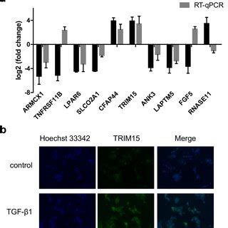 Validation Of Microarray Data By RT QPCR And Immunofluorescence A The