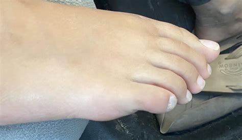 Why Do My Toes Curl Down Like This Rpodiatry