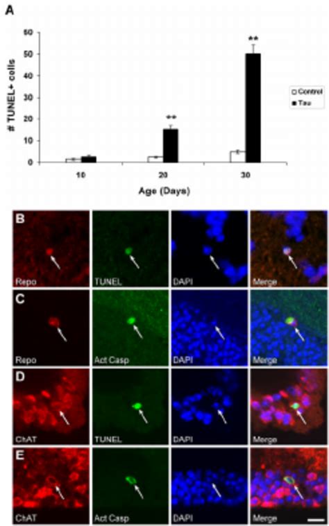 Age Dependent Apoptotic Glial And Neuronal Cell Death In Glial Tau