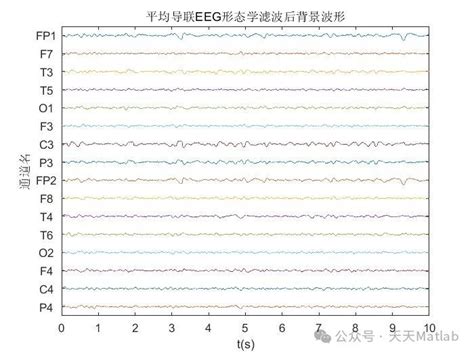 【脑电信号】基于形态学滤波的脑电信号eeg处理附matlab代码eeg 代码 Csdn博客