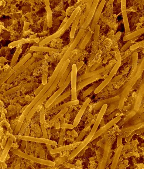 Oral Bacterium Actinomyces Viscosus Sem Stock Image C0322171 Science Photo Library