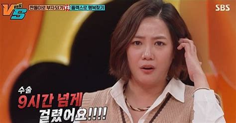 코 재수술 후 처음 방송 출연이다 고은아 중형차 한 대 값 들어간 코 수술 비하인드 공개충격
