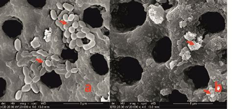 Scanning Electron Microscopy Of Enterococcus Faecalis 21 Day Old