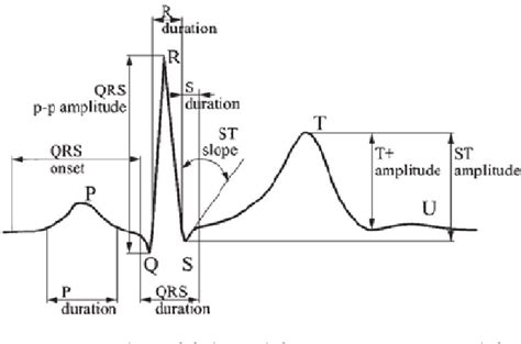 Figure 11 From Ecg Biometrics Using Deep Neural Networks Semantic Scholar