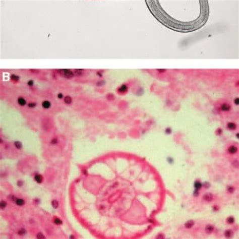 Faecal Egg Count Reduction Test Fecrt 10 Days After Administration